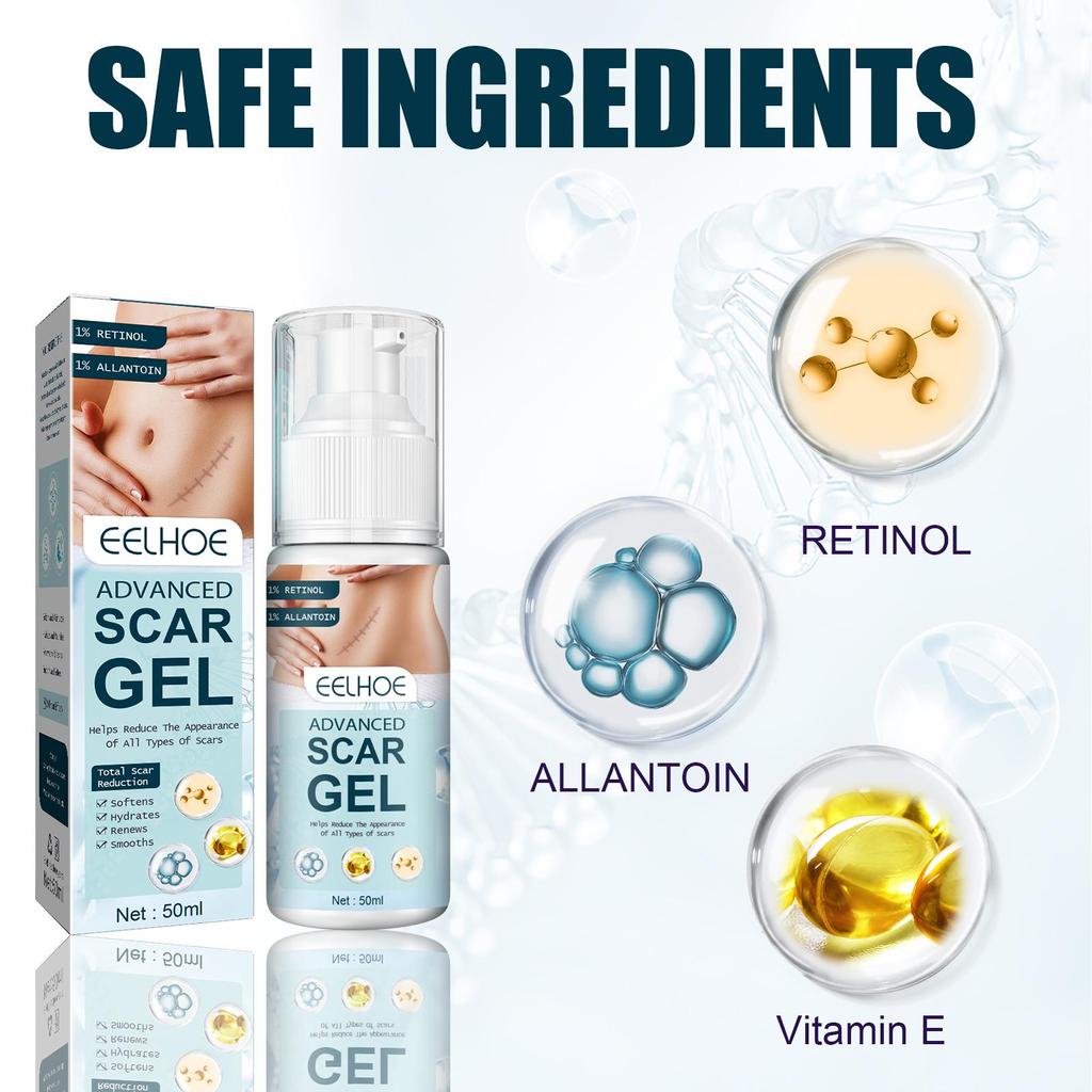 Buy Scar Removal Cream Acne Pimples Stretch Marks Treatments Promote ...