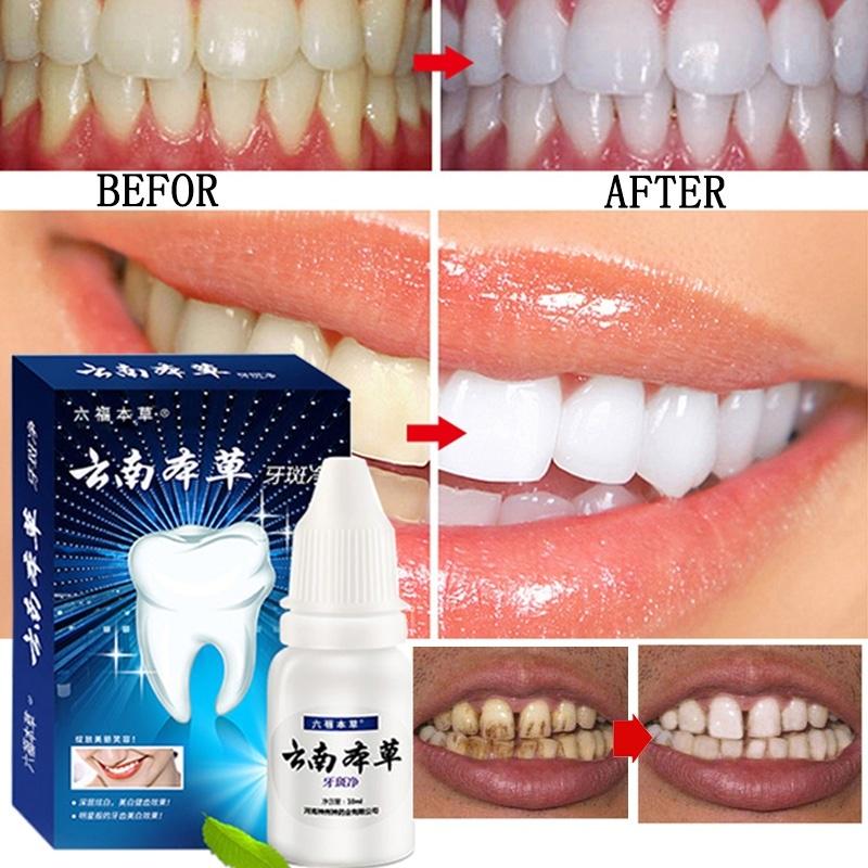 Buy 10Ml Magic Natural Teeth Whitening Oral Hygiene Care Tooth Cleaning ...