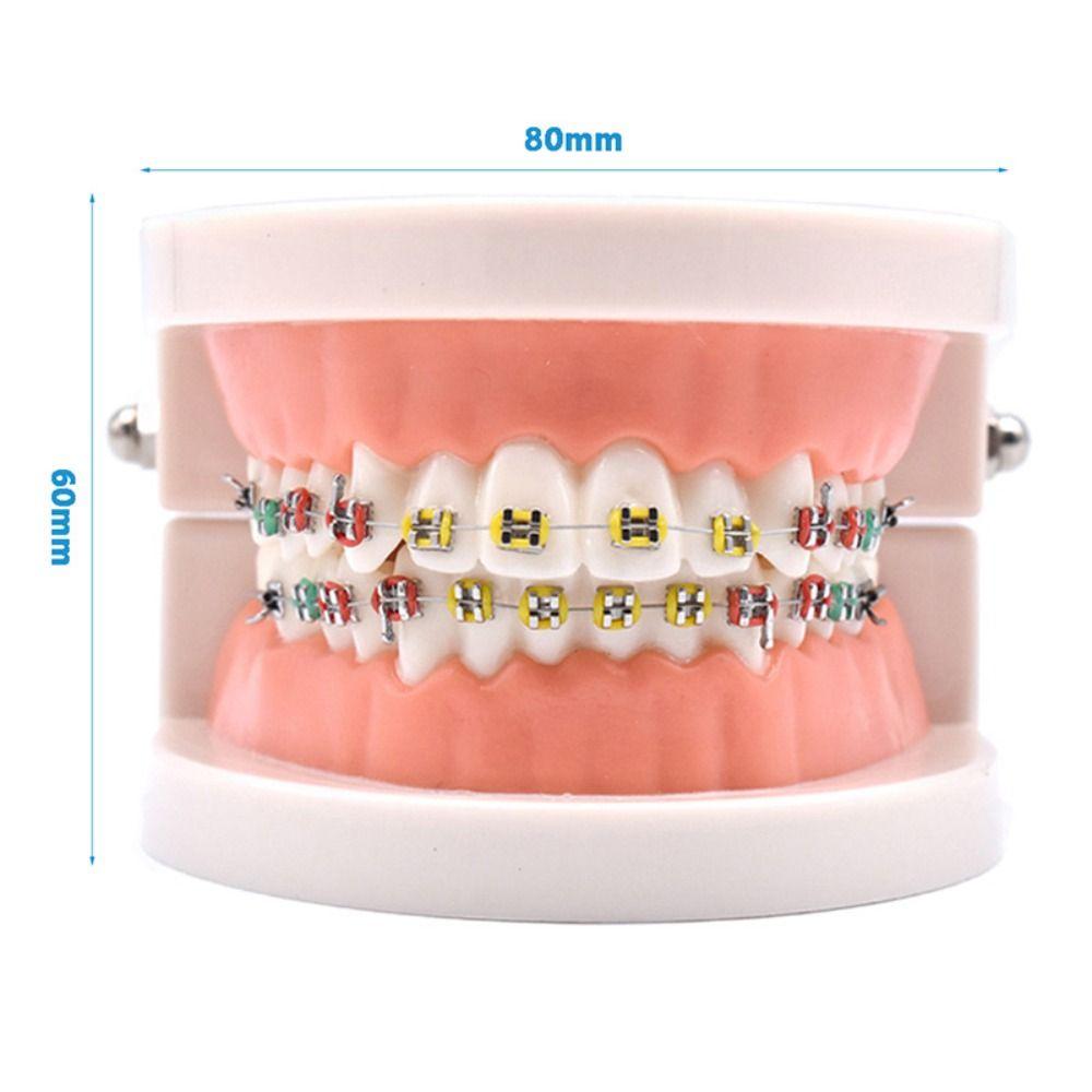 Cumpără Model de dinți ortodontici pentru gingii roz carne cu brackets ...