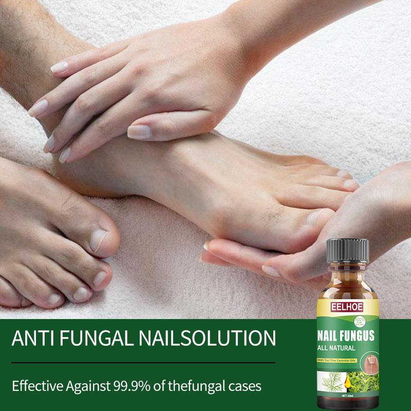 Buy 30Ml Toe Nail Tea Tree Oil Fungus Care Solution Onychomycosis ...