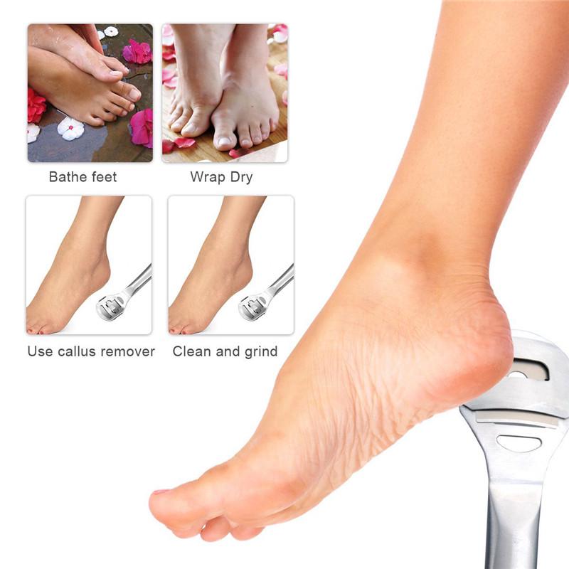 Buy Corn Cutter Callus and Hard Skin Remover Foot File Razor with 10 ...