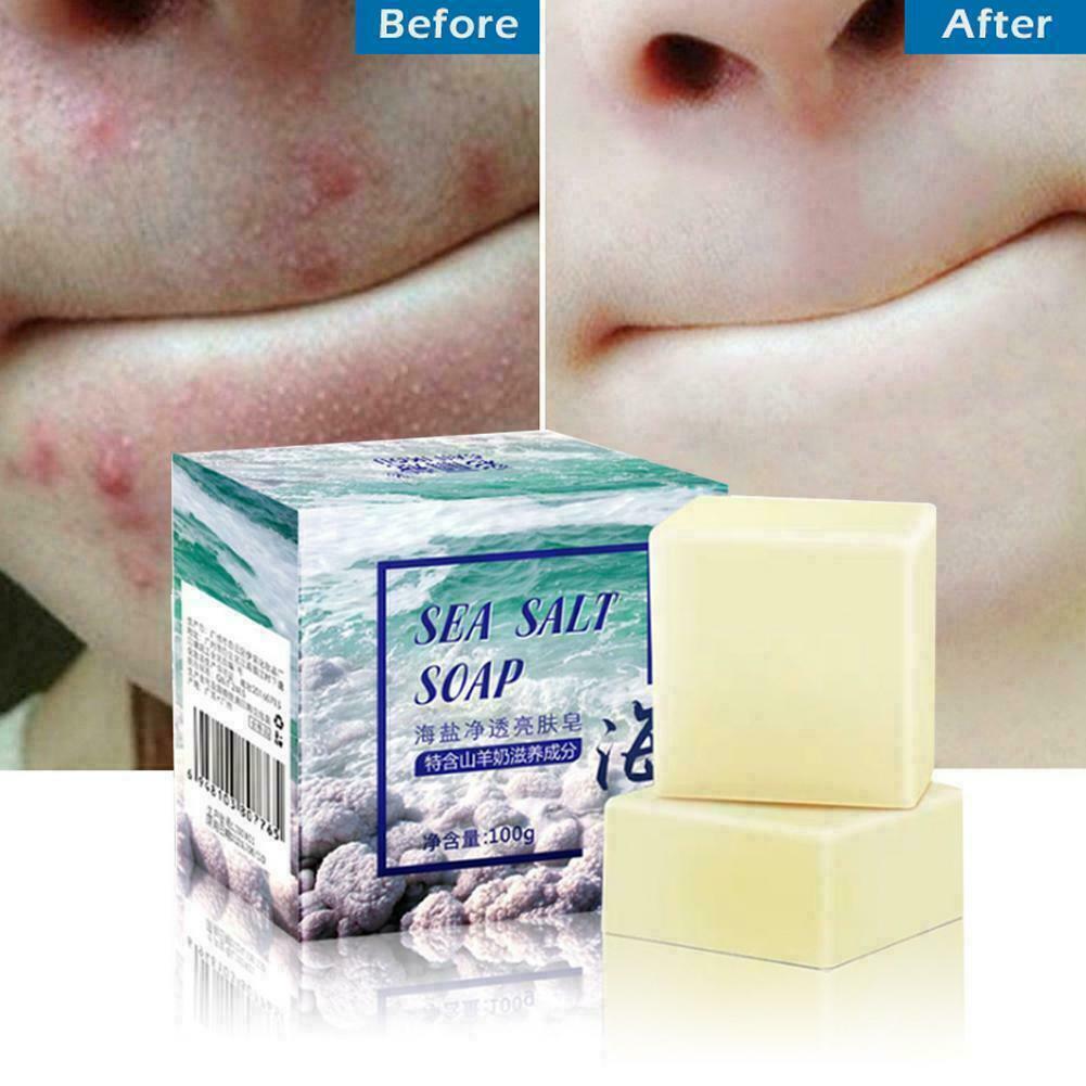 Buy Sea Salt Soap Whitening Moisturizing Soap Body Face Pimple ...