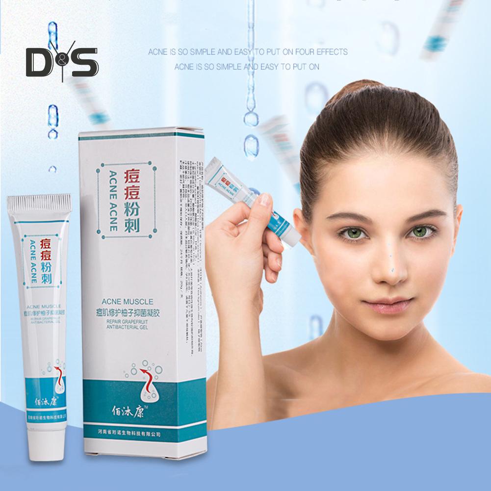 Tendre Poison Acne Remove Cream Red Spots Pimple Scars Repairing Gel ...