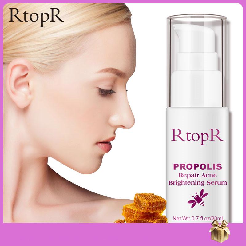 Propolis Repair Acne Brightening Serum Scar Spots Cleaning Shrink Pores ...
