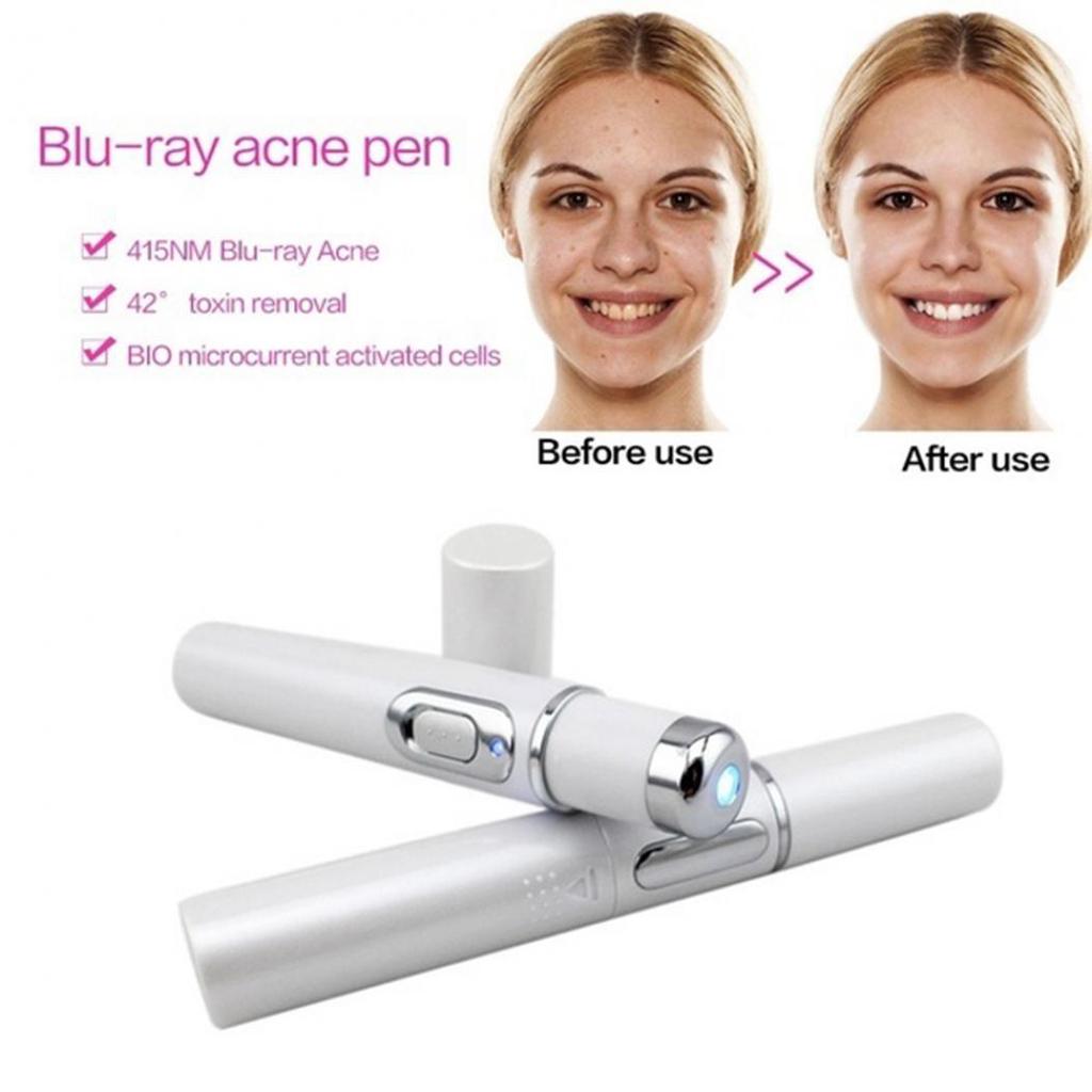 Buy Laser Removing Spots Dark Spots Acne Removal Pen Medical Blue Light ...