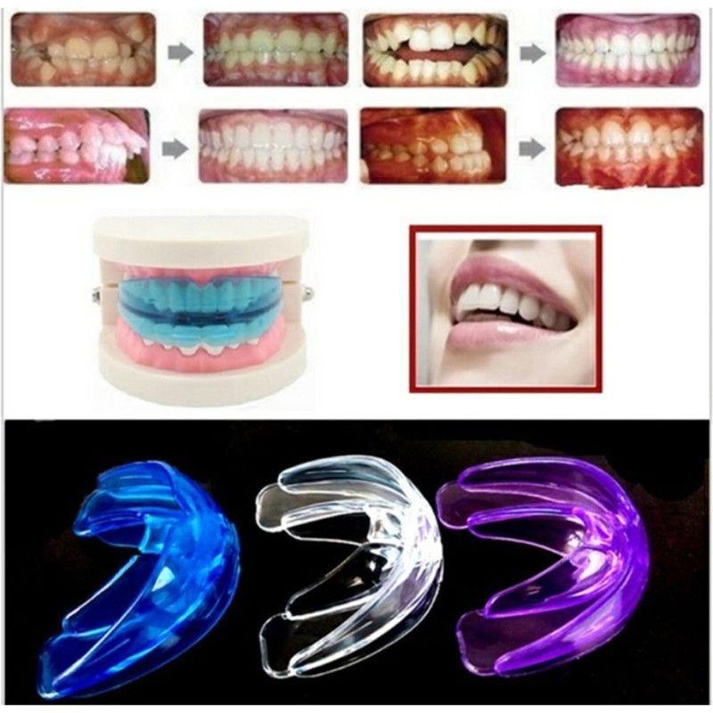Buy 1PC Silicone Soft Orthodontic Retainer Teeth Corrector ...