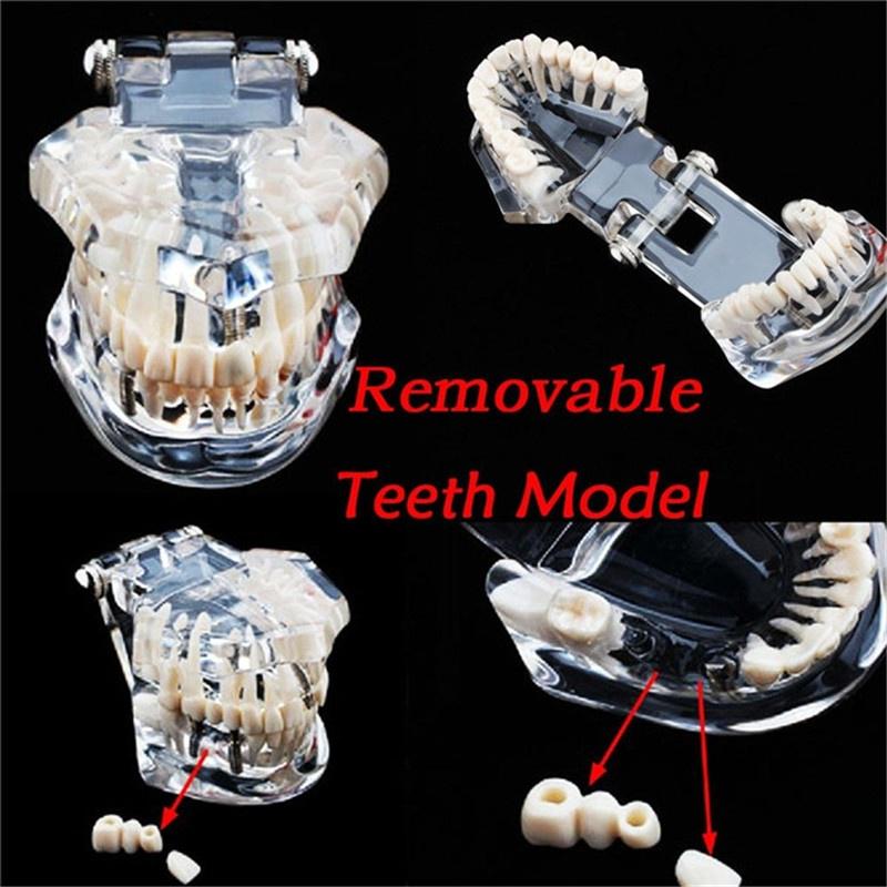 Buy Tooth Activity Model Study Teaching Detachable Tooth Models at ...