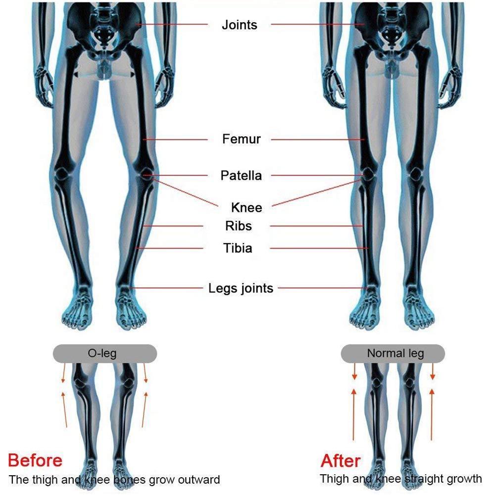 1 Pair Care Increase Height Brioche Silicone Insole Leg Varus Orthotics ...