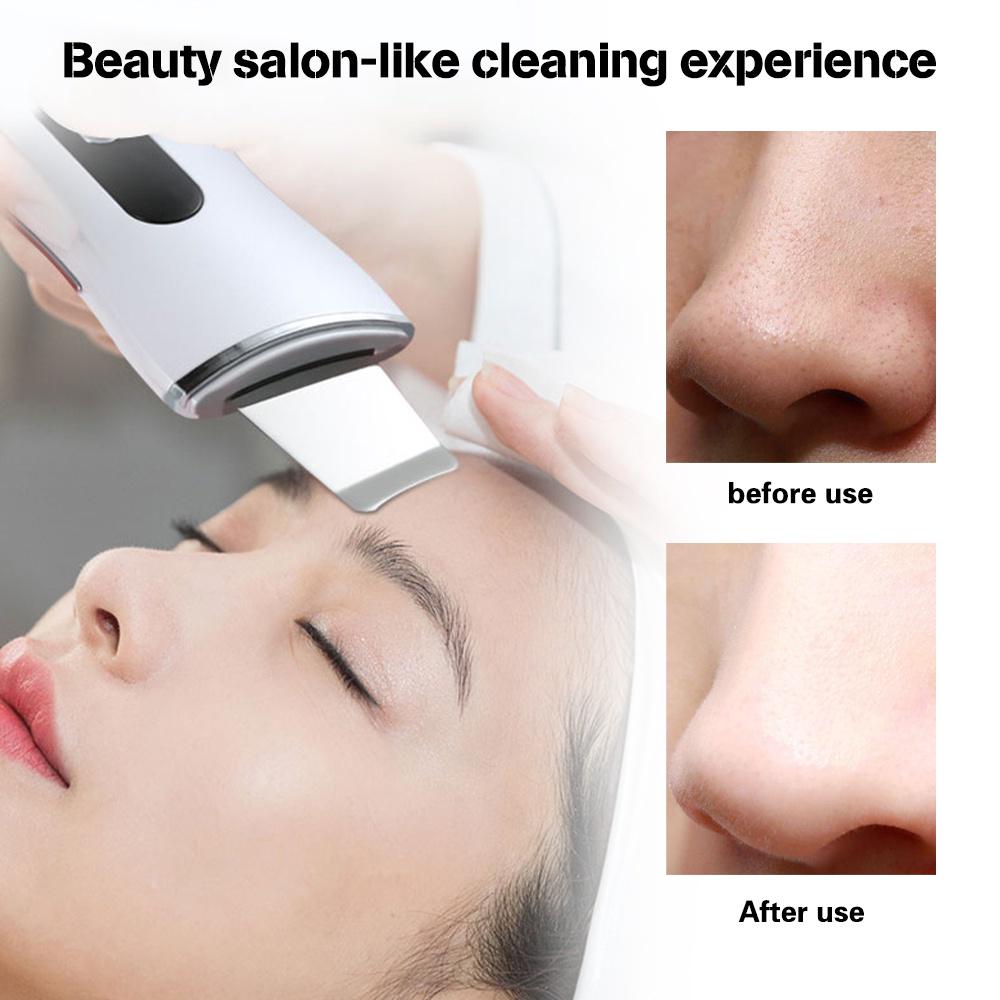Cheap Ultrasonic Skin Scrubber Facial Peeling USB Face Cleaner Acne ...