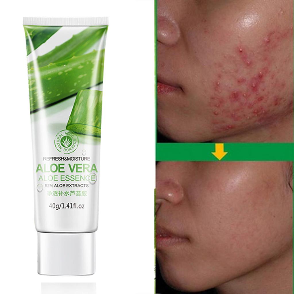 Buy 40g Face Skin Care Acne Cream Oil Control Acne Products Face Cream ...