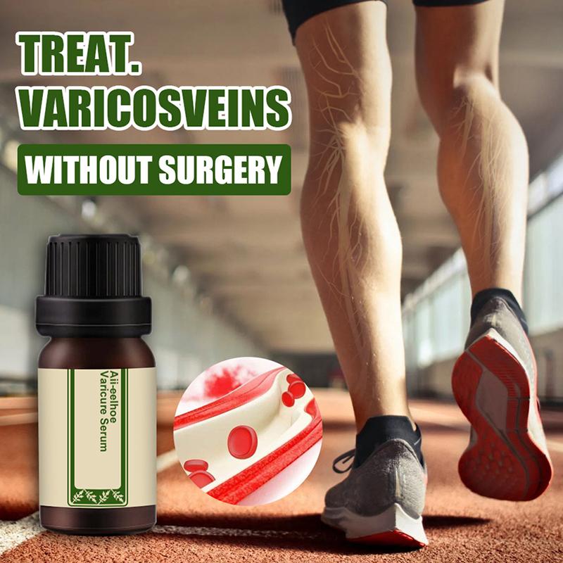 Buy Treat Varicose Vascular Inflammation Massage Cream Cure Varicose ...