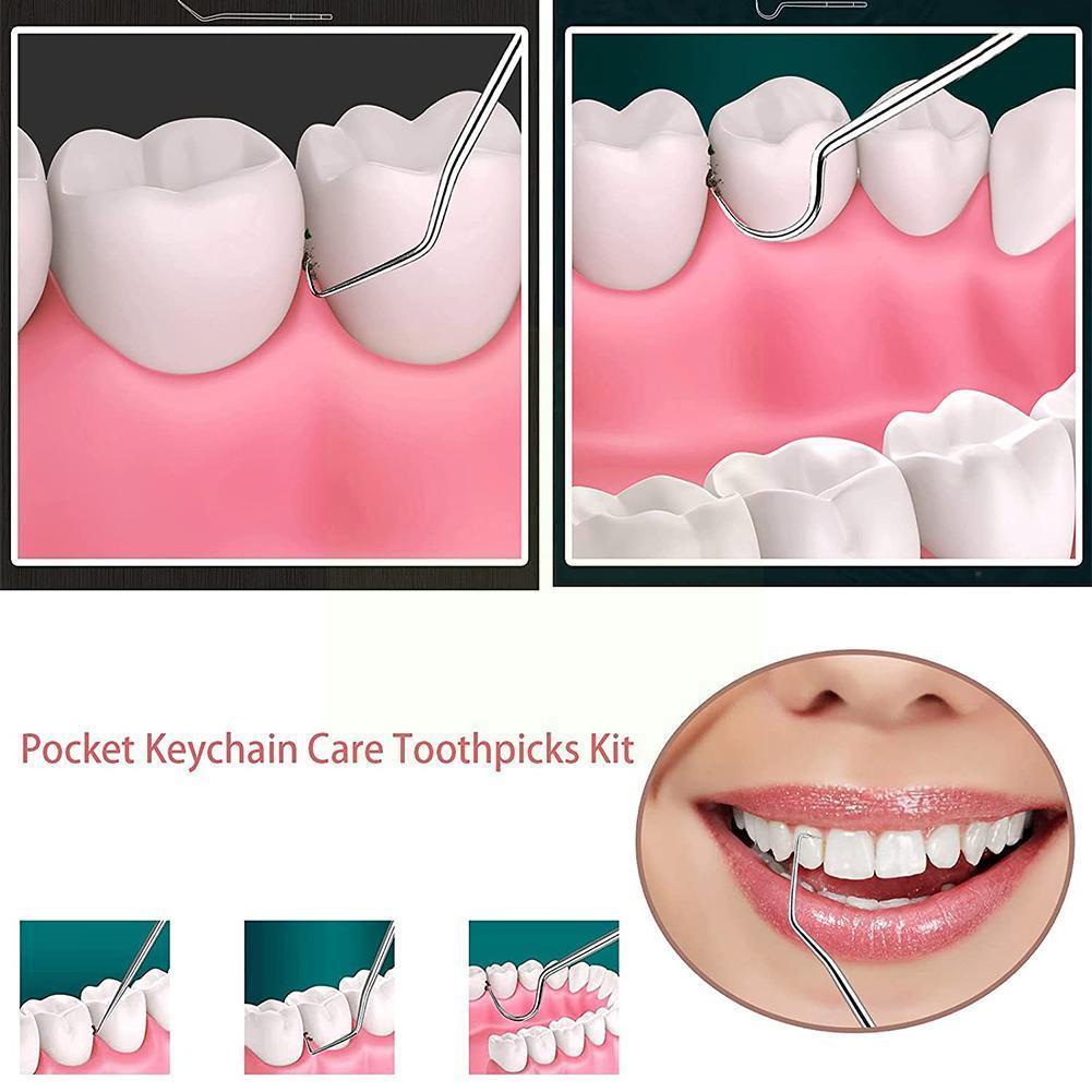 Buy 1pc Dental Mirror Steel Dental Dentist Prepared Tool Sickle ...