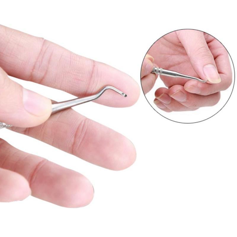 Buy Toe Nail Orthotics Ingrown Toenail Correction Tool Pedicure Tool ...