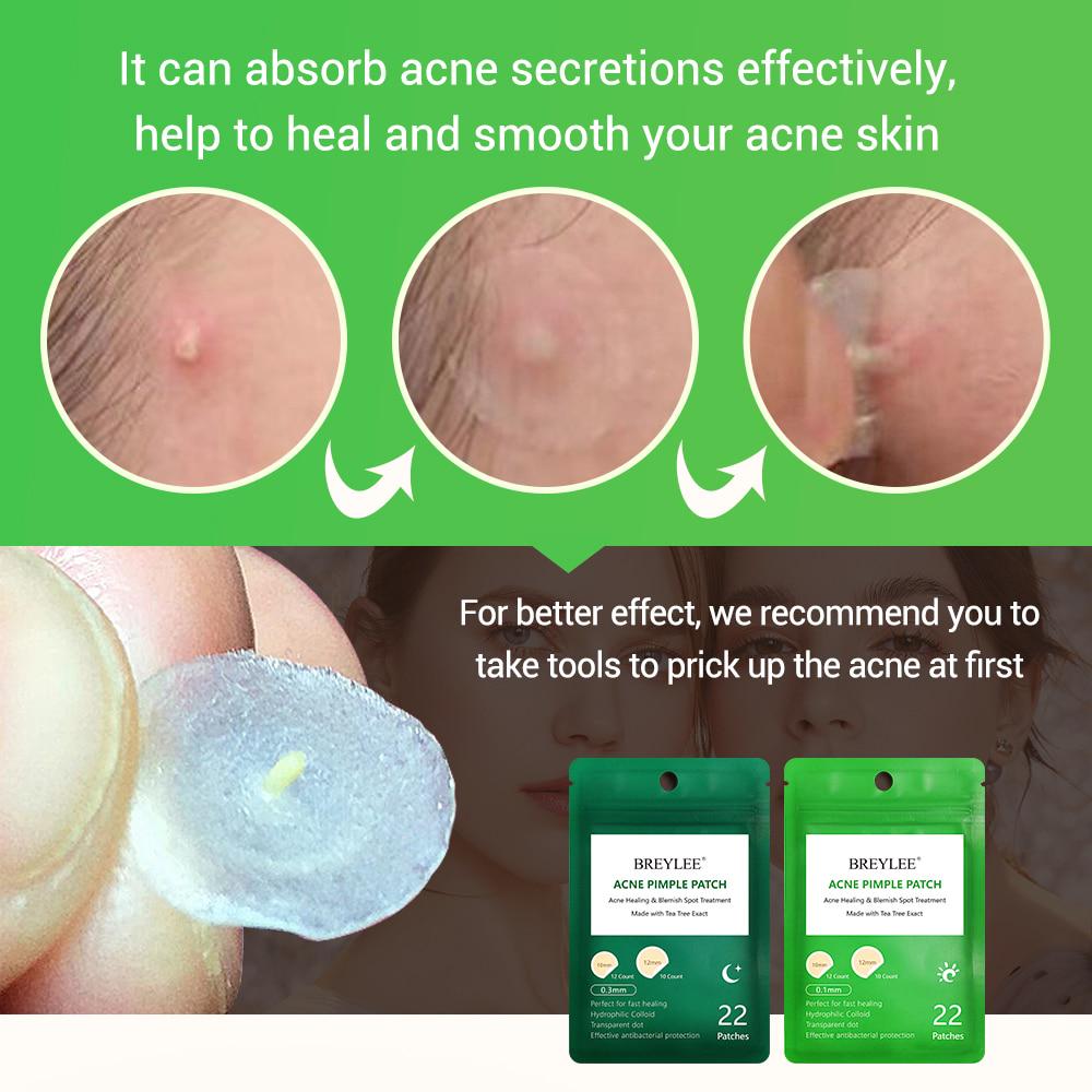 Acne Pimple Patch Face Mask Skin Care Acne Treatment Serum Face Cream ...